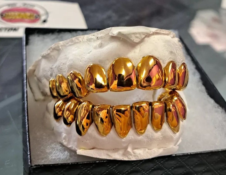 Non-Precious Dental Gold(NPG) Gold Alternative | The plug custom grillz